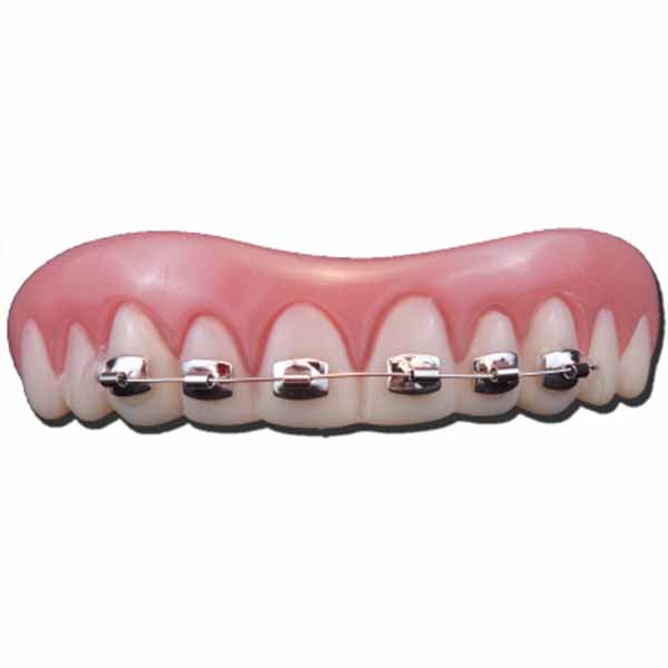 Braces Fake Teeth – The Party Place